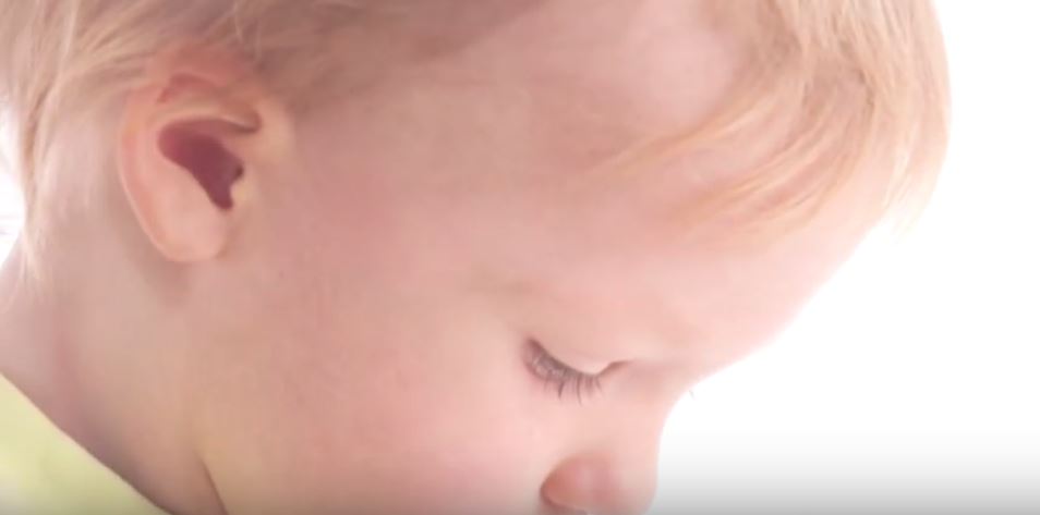 Understanding Hair Loss In Children | Hair Heroes Rescue